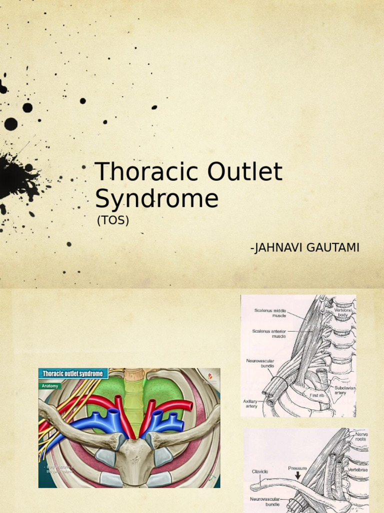 Tos Lecture 3rd Yr | PDF | Musculoskeletal System | Clinical Medicine