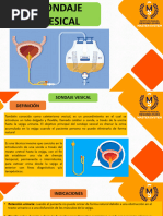 Procedimiento de Sondaje Vesical | PDF | Urología | Especialidades Medicas