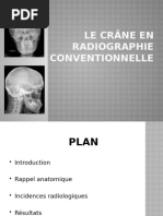 5-ANATOMIE DE L'OREILLE INTERNE Labyrinthe Osseux N@sser | PDF ...