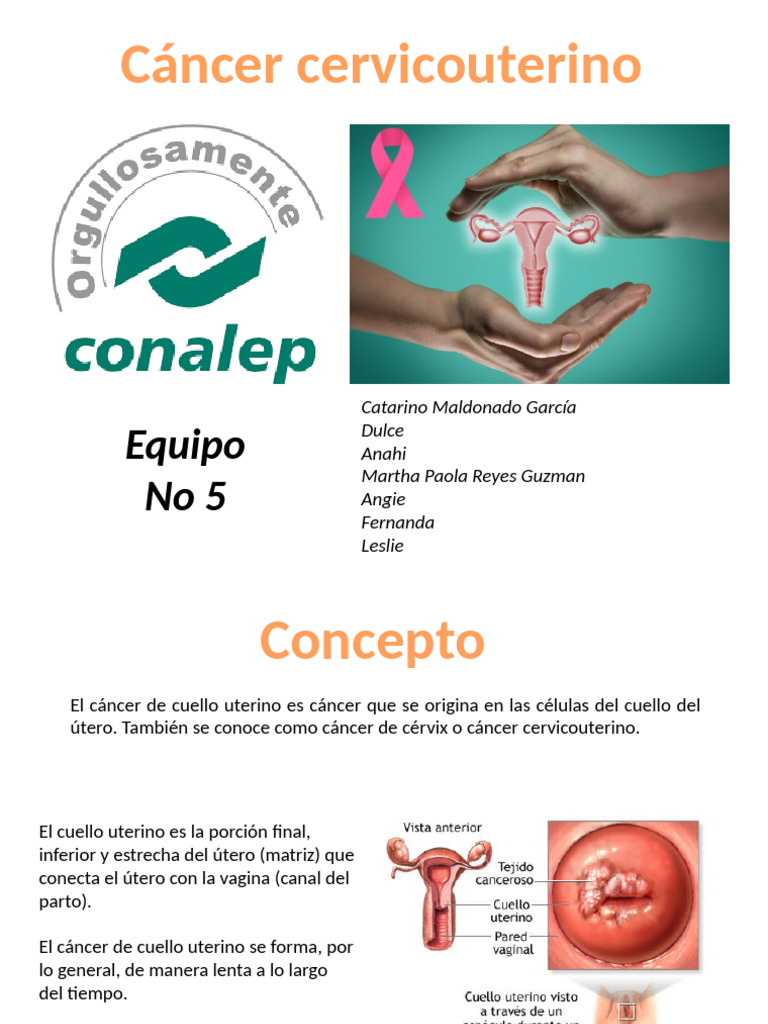 Cáncer Cervicouterino: Síntomas y Tratamiento | PDF