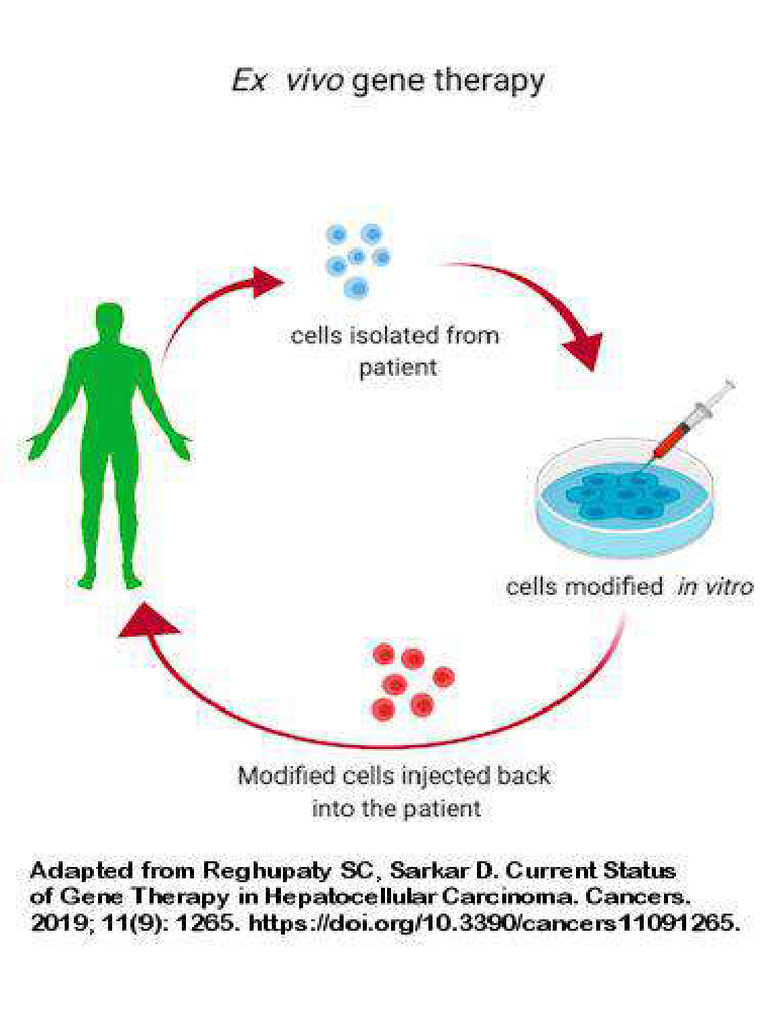 Ex Vivo Gene Therapy | PDF