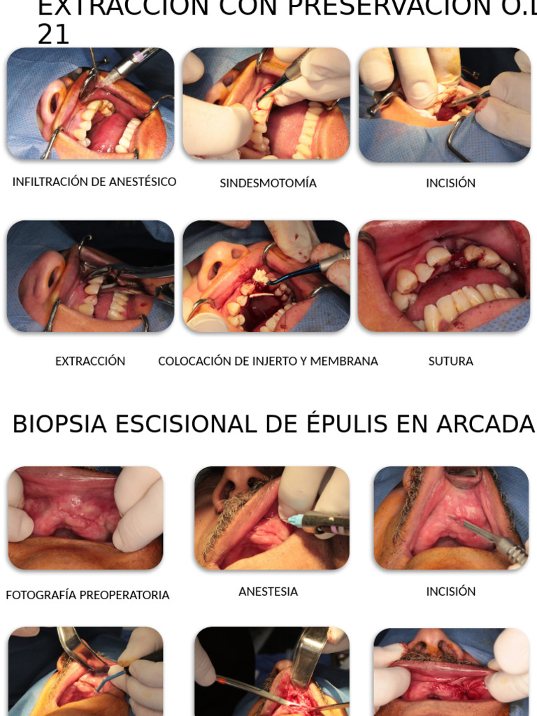 Casos Cx de R2 | PDF | Procedimientos médicos | Especialidades Medicas