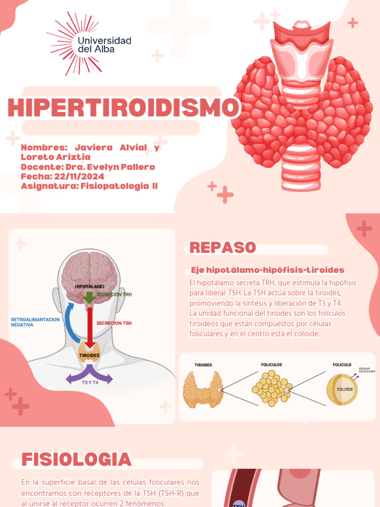 HIPERTIROIDISMO | PDF | Hipertiroidismo | Tiroides