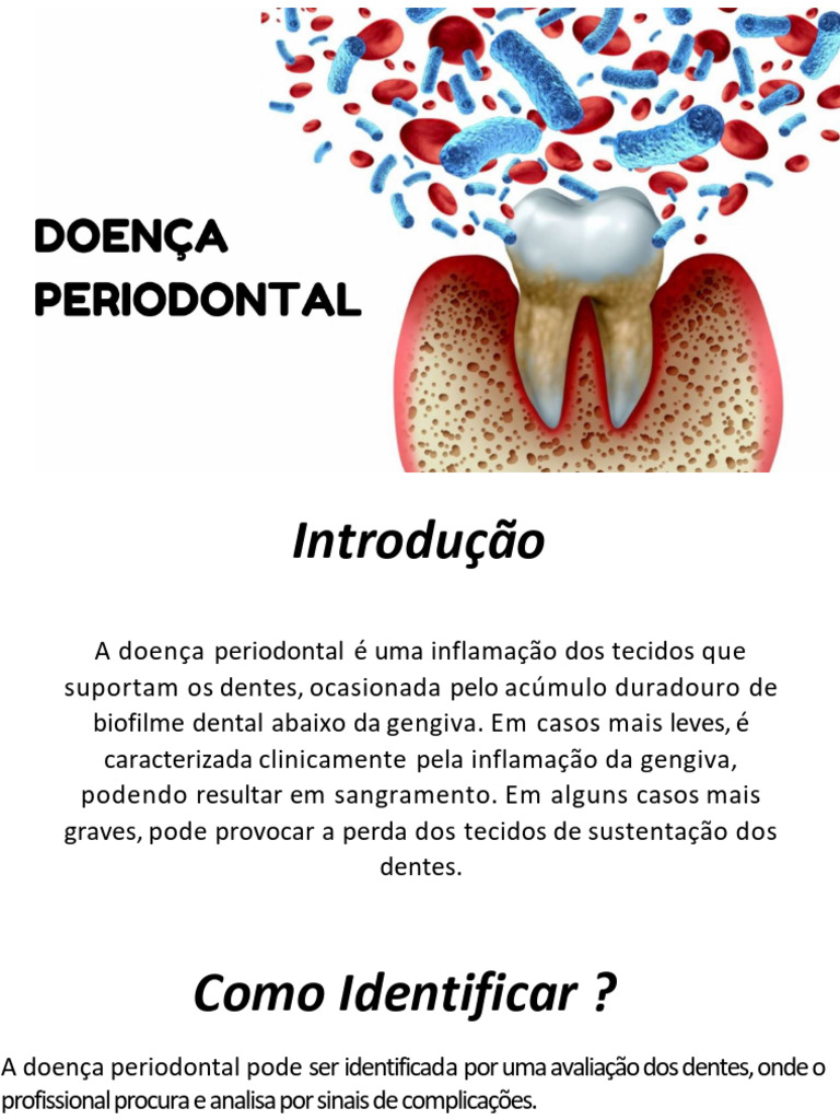 Sintomas e Tratamento da Doença Periodontal | PDF | Especialidades ...