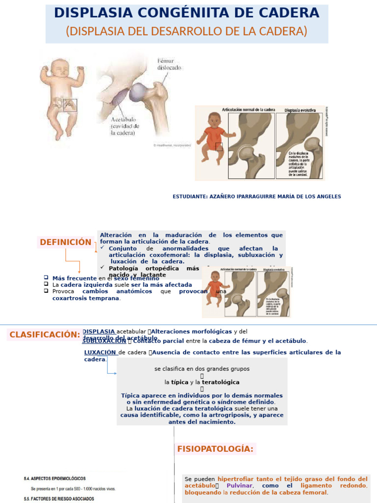 Displasia Congénita de Cadera en Bebés | PDF | Sistema musculoesquelético