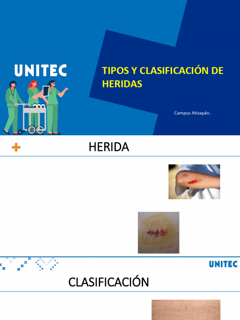 Tipos y Clasificación de Heridas | PDF