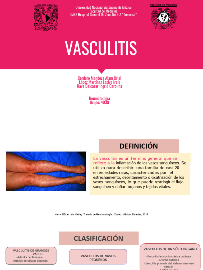 Vasculitis | PDF | Epidemiología | Inmunología