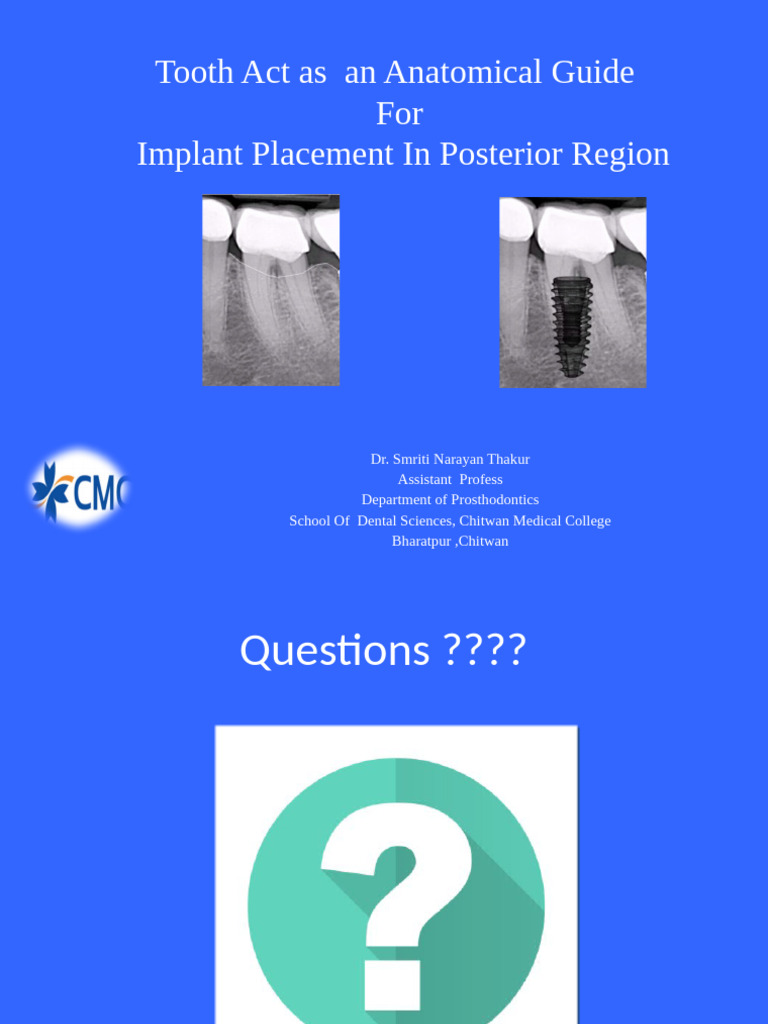 Tooth Act as an Anatomical Guide | PDF | Dental Implant | Health Sciences