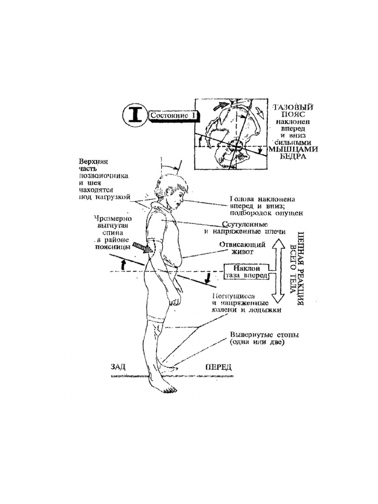 Egoscue - Posture Correction | PDF