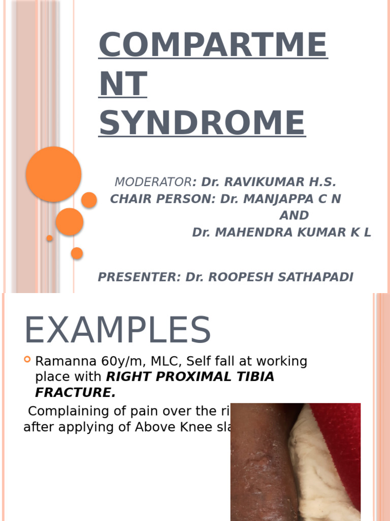 Compartment Syndrome | PDF | Thumb | Diseases And Disorders
