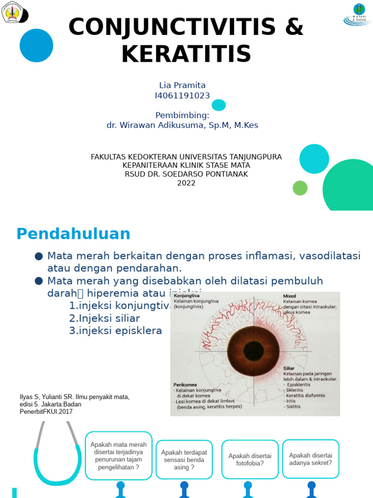 Keratitis & Konjungtivitis - Lia Pramita | PDF | Medical Specialties | Diseases And Disorders