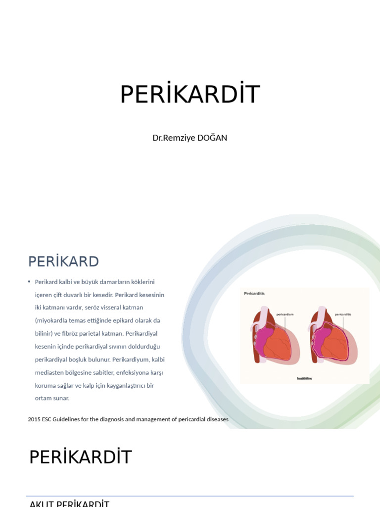 Perikardit SON HALİ | PDF