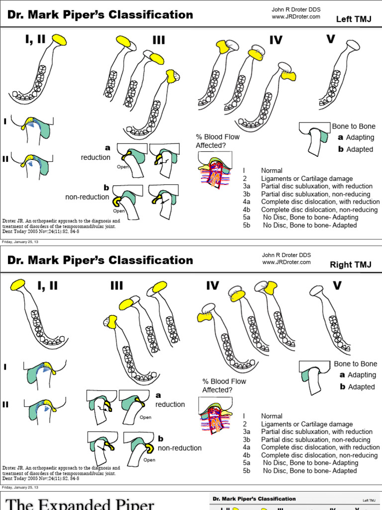 Piper Classification Card | PDF | Musculoskeletal System | Joints