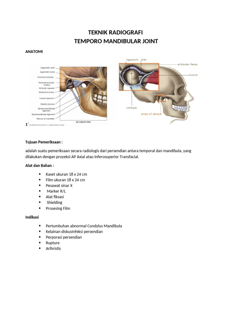 Teknik Radiografi TMJ | PDF