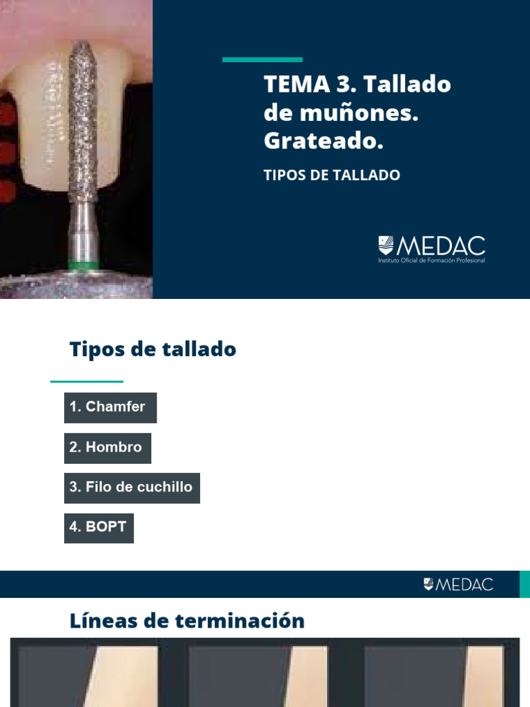 Tipos de Tallado de Muñones y Técnicas | PDF