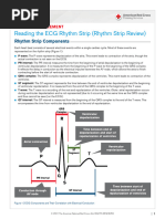 Ecg Interpretation J Point Stemi Criteria Equivalents and Others | PDF ...