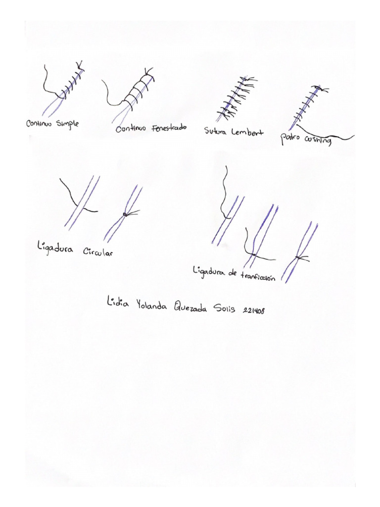 Sutura Lembert | PDF