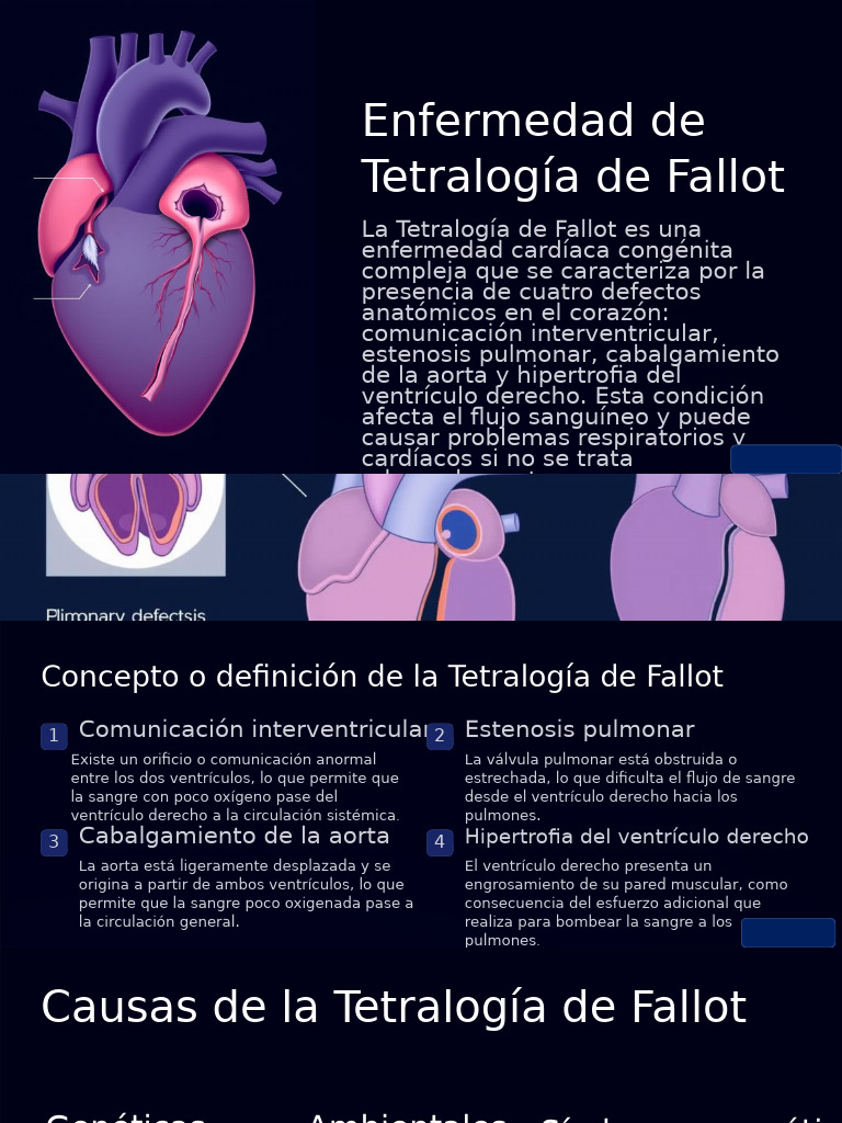 Tetralogía de Fallot: Causas y Tratamiento | PDF | Corazón | Ventrículo ...