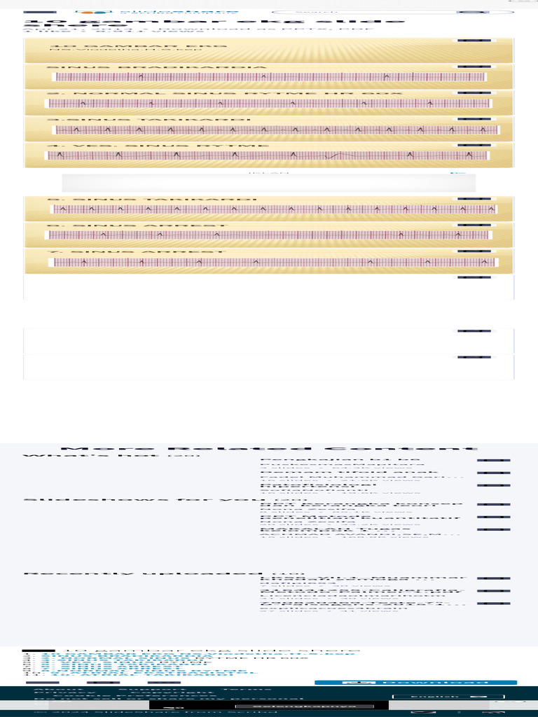 10 Gambar Ekg Slide Shere PPT | PDF