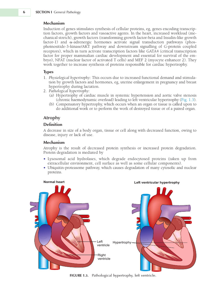 Cardiac Hypertrophy and Atrophy Mechanisms | PDF | Epithelium | Atrophy