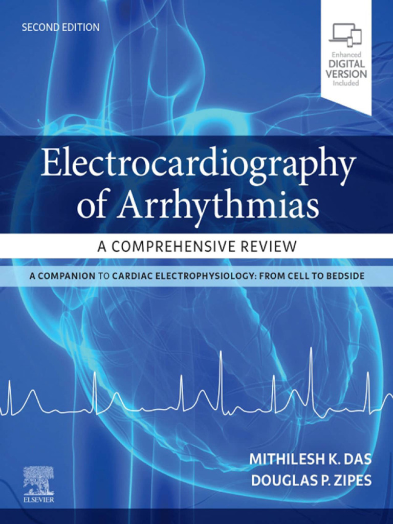 Electrocardiography of Arrhythmias A Comprehensive Review (A Companion ...