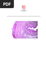 Pathoma Fundamentals of Pathology | PDF