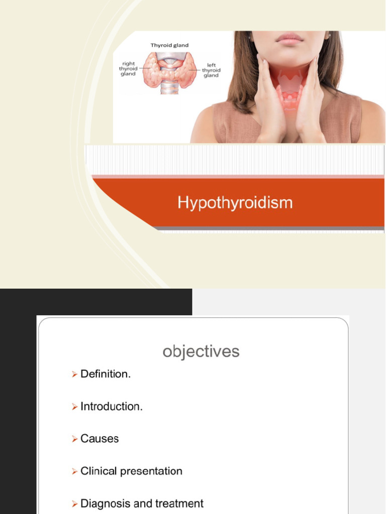 Lecture 11 Hypothyroidism | PDF