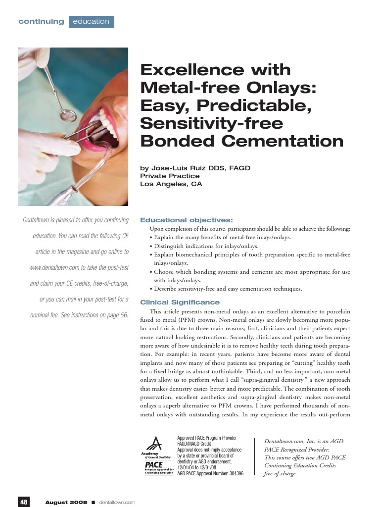 Excellence with Metal-free Onlays: Easy, Predictable, Sensitivity-free ...