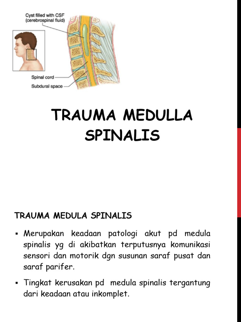 Trauma Medula Spinalis | PDF