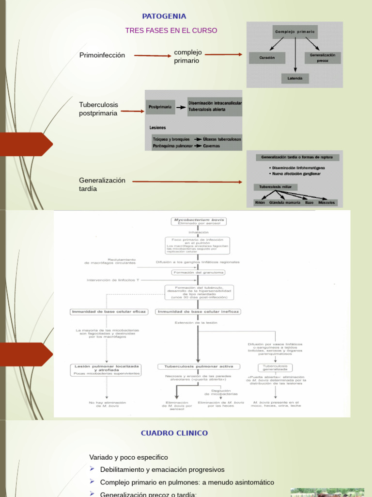 Tuberculosis 2 | PDF