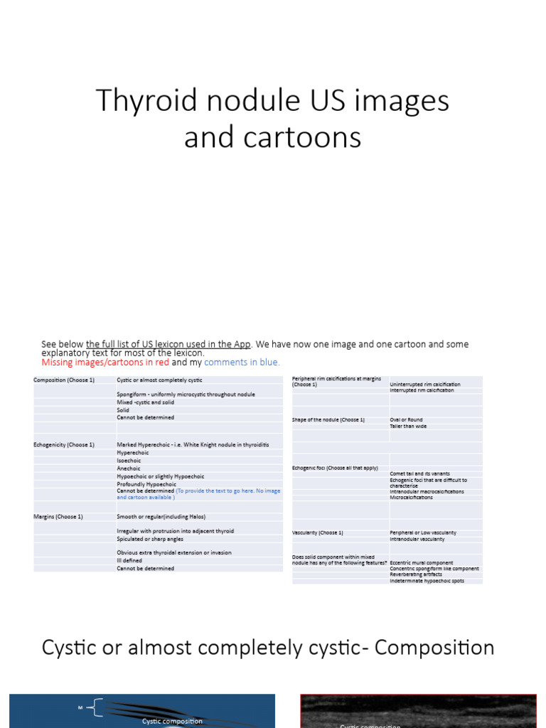 Thyroid Nodules - Description | PDF | Thyroid