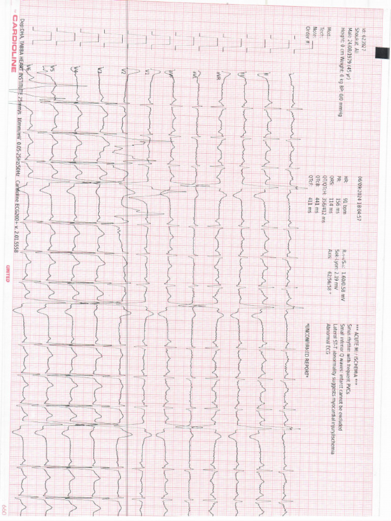 ECG-1 | PDF