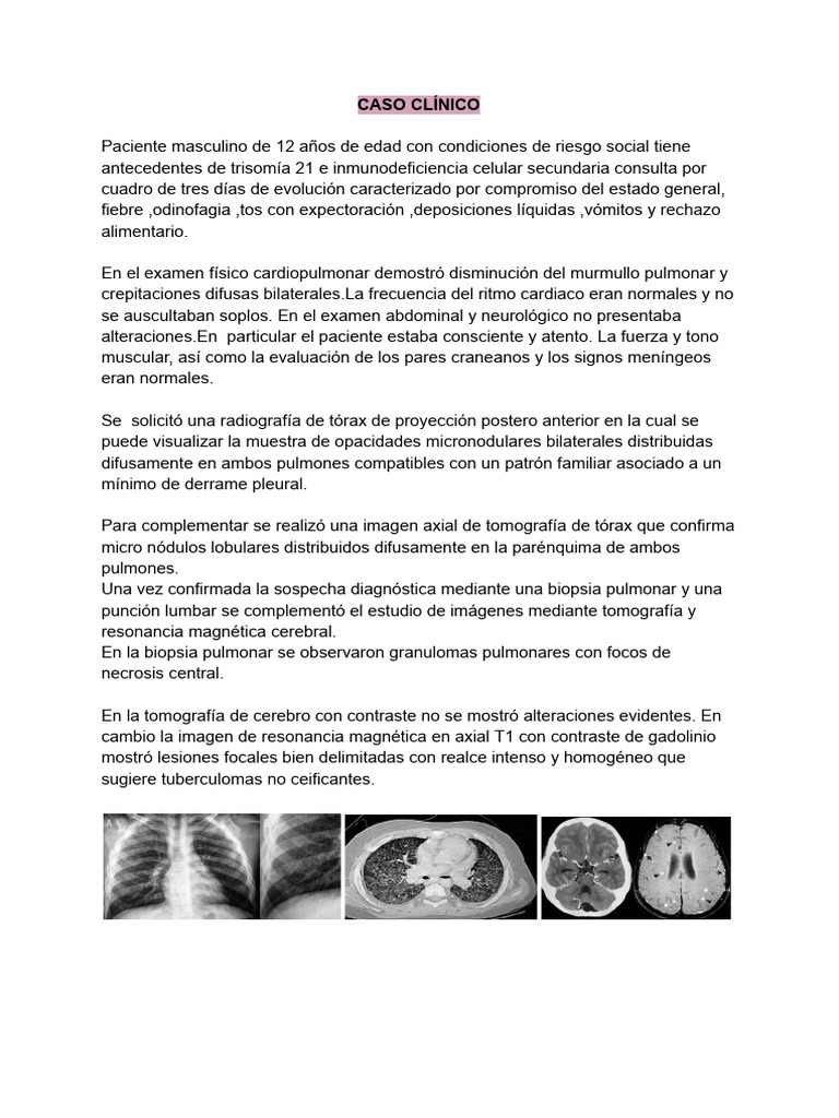 Tuberculosis en niño con inmunodeficiencia | PDF | Tuberculosis ...