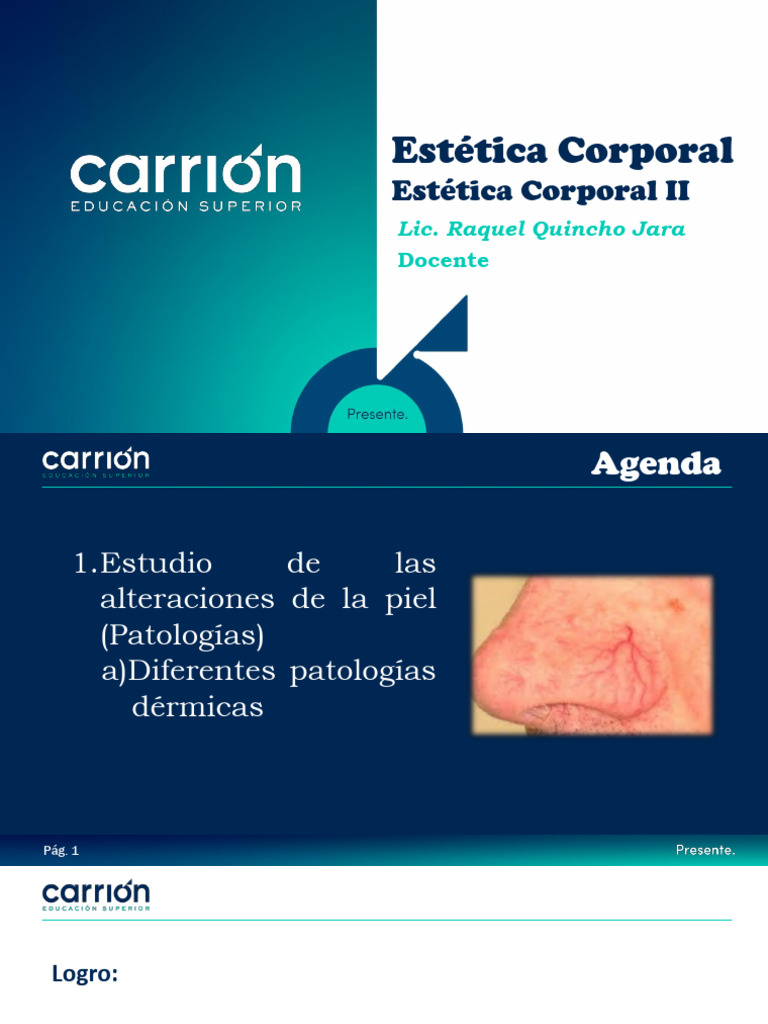 Caparrosa y Alteraciones Vasculares | PDF | Sistema linfático | Cáncer