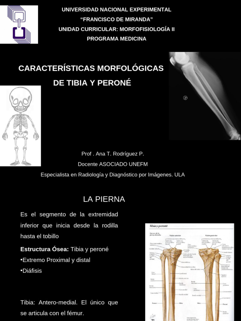 Morfología de Tibia y Peroné | PDF