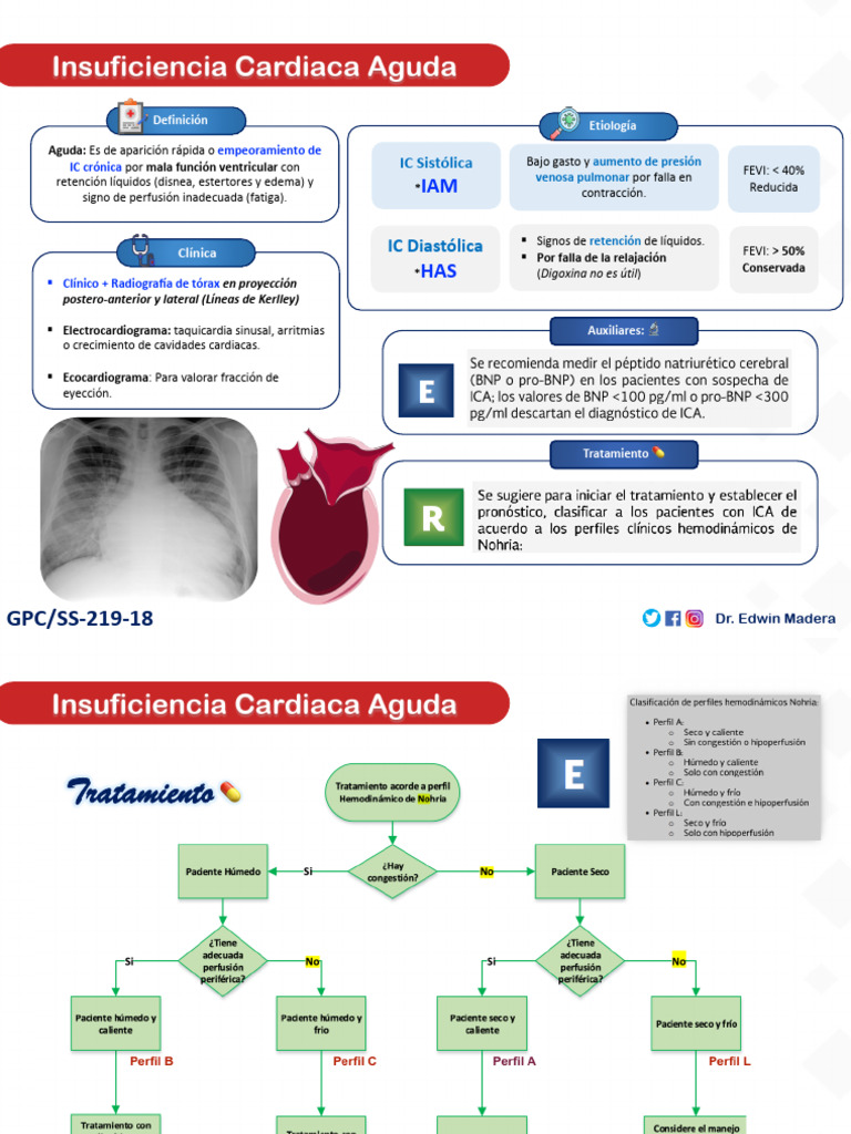 Insuficiencia Cardiaca Aguda | PDF