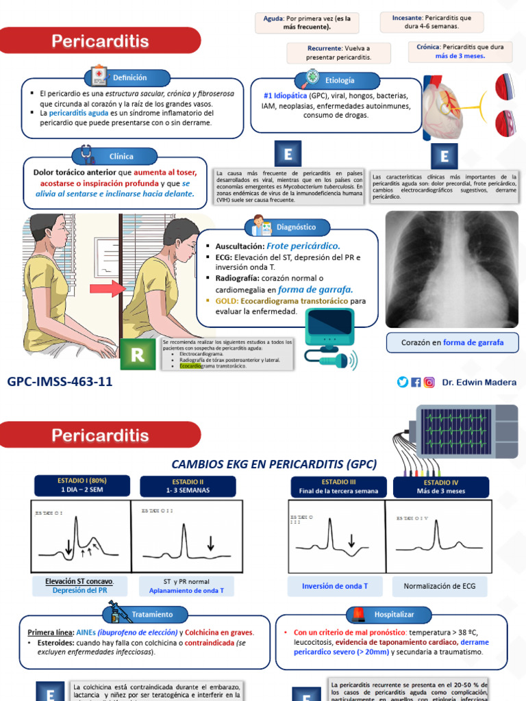 Pericarditis Aguda: Diagnóstico y Tratamiento | PDF | Enfermedades y ...