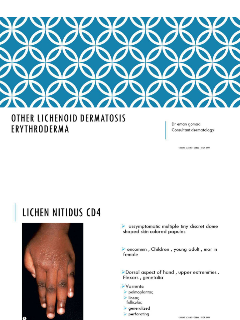 Other Lichenoid Dermatosis | PDF
