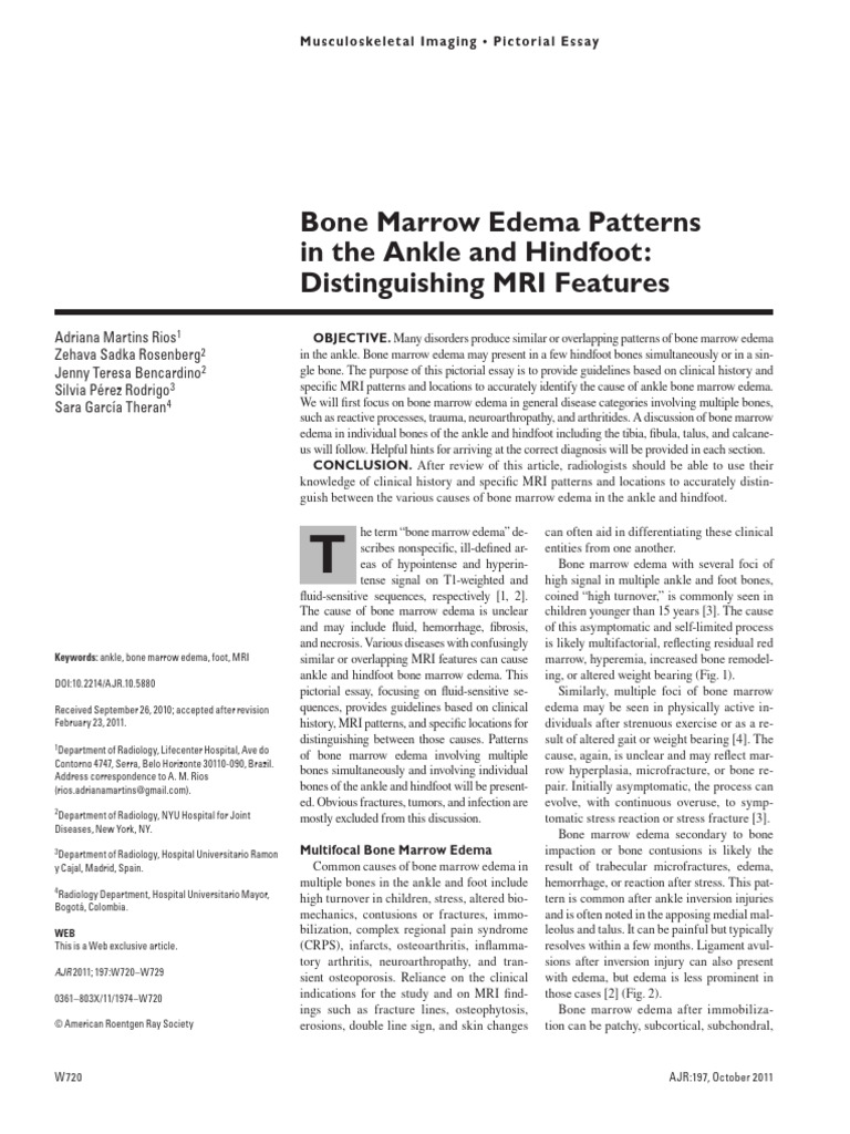 Rios Et Al 2012 Bone Marrow Edema Patterns in The Ankle and Hindfoot Distinguishing Mri Features ...