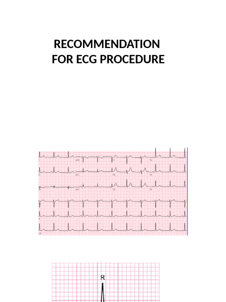 ECG PROCEDURE | PDF | Electrocardiography | Clinical Medicine