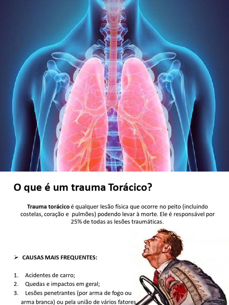 Aula 11 - Trauma de Torácico | PDF | Coração | Especialidades médicas