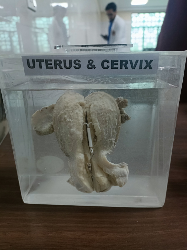 Patho Gross Specimens | PDF