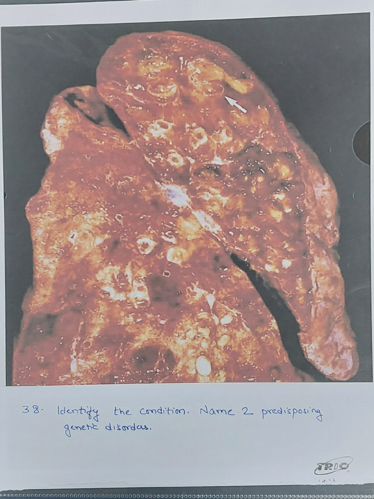 Patho Spotters | PDF