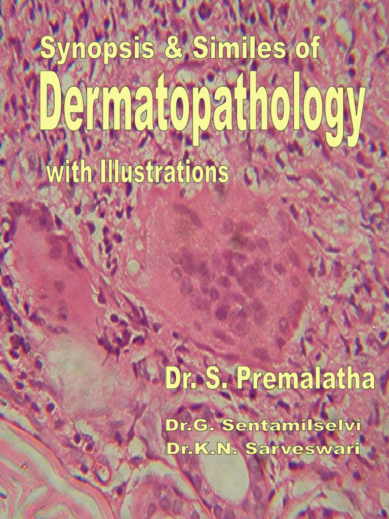 Synopsis & Similes of Dermatopathology With Illustrations | PDF