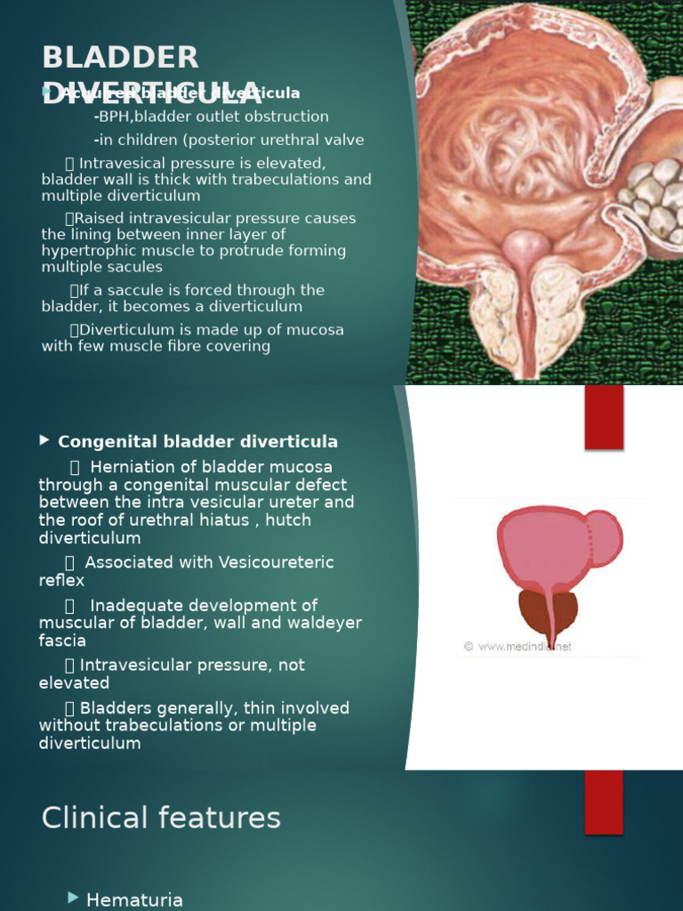 Benign Urinary Bladder | PDF | Urinary Incontinence | Human Anatomy