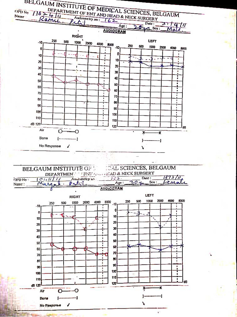 ENT audiograms | PDF | Otology | Surgical Specialties