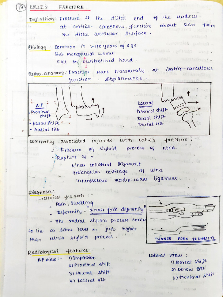 Final year Ortho Fracture 2 | PDF