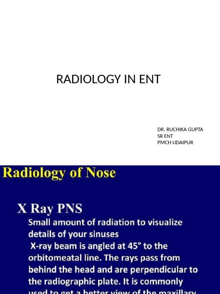 Radiology in Ent | PDF
