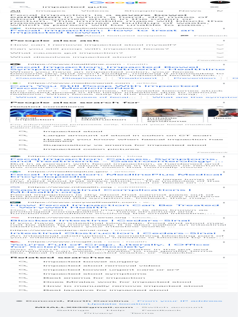 Impacted Guts - Google Search | PDF | Human Feces | Gastroenterology