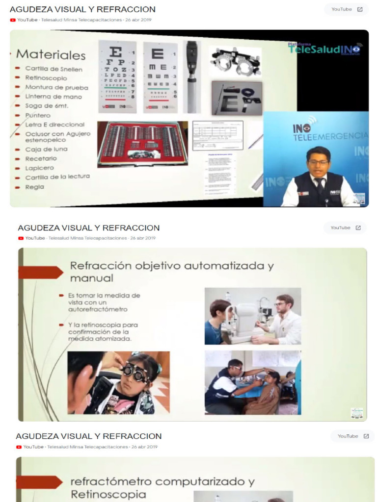 Agudeza Visual | PDF